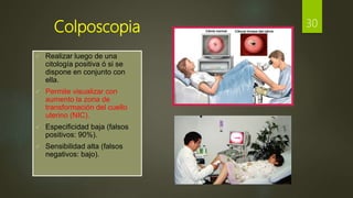 Lesiones intraepiteliales cervicales | PPTX