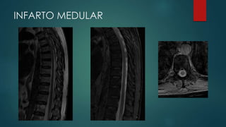 Lesiones medulares | PPTX