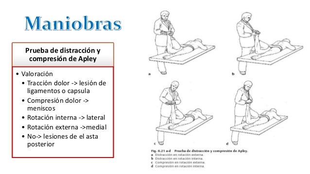 Meniscos y ligamentos de rodilla