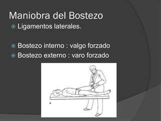 Lesiones meniscales y ligamentarias de la rodilla | PPTX