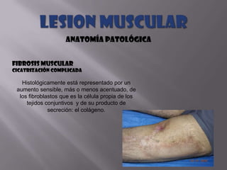 Lesiones musculares | PPTX