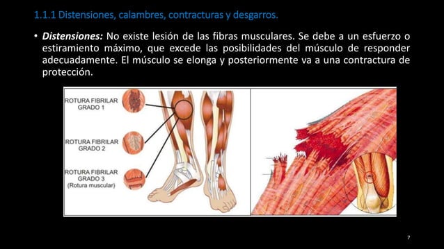 Lesiones musculares. | PPT
