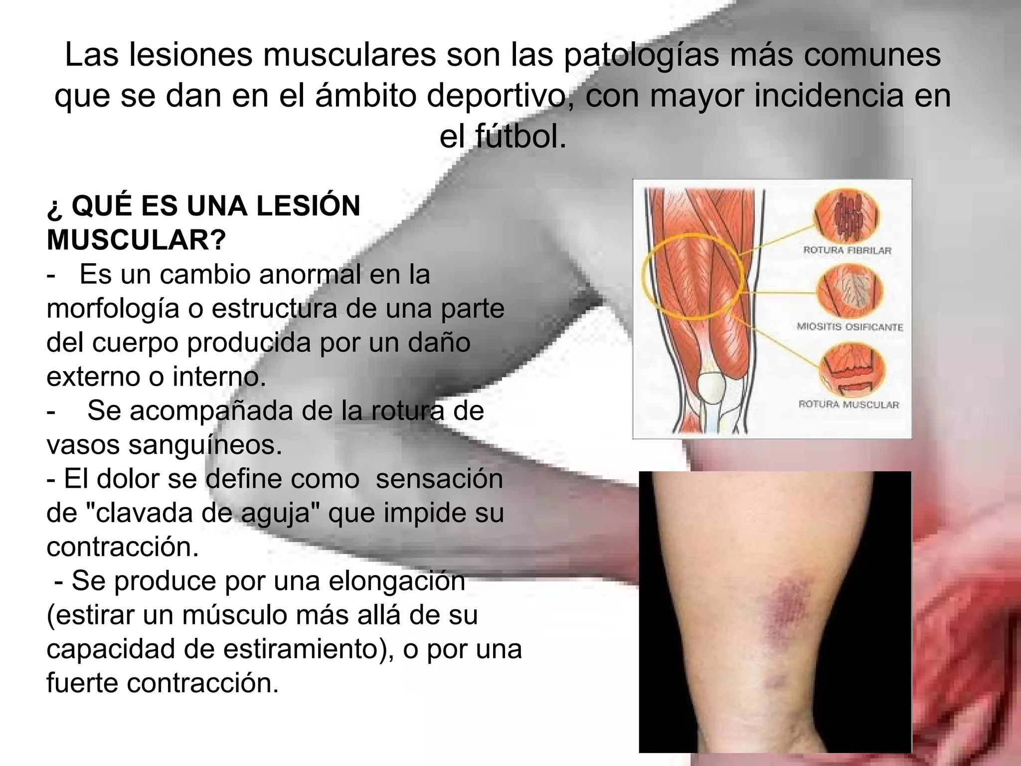 lesiones0 | PPT