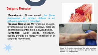Lesiones musculares (Fracturas).pptx