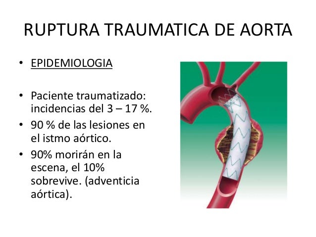 TRAUMA TORÁCICO - Mind Map