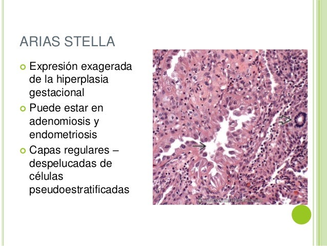 Lesiones no neoplasicas del endometrio