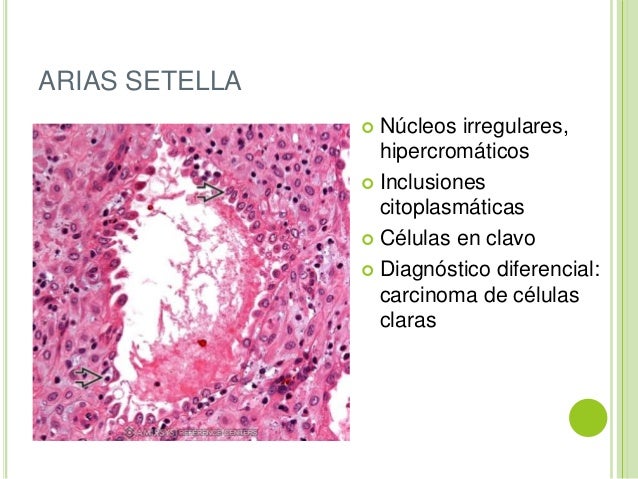Lesiones no neoplasicas del endometrio