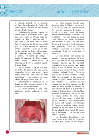 (2015-05-14) Úlceras orales (DOC) | DOCX
