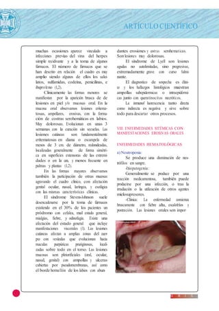(2015-05-14) Úlceras orales (DOC) | DOCX