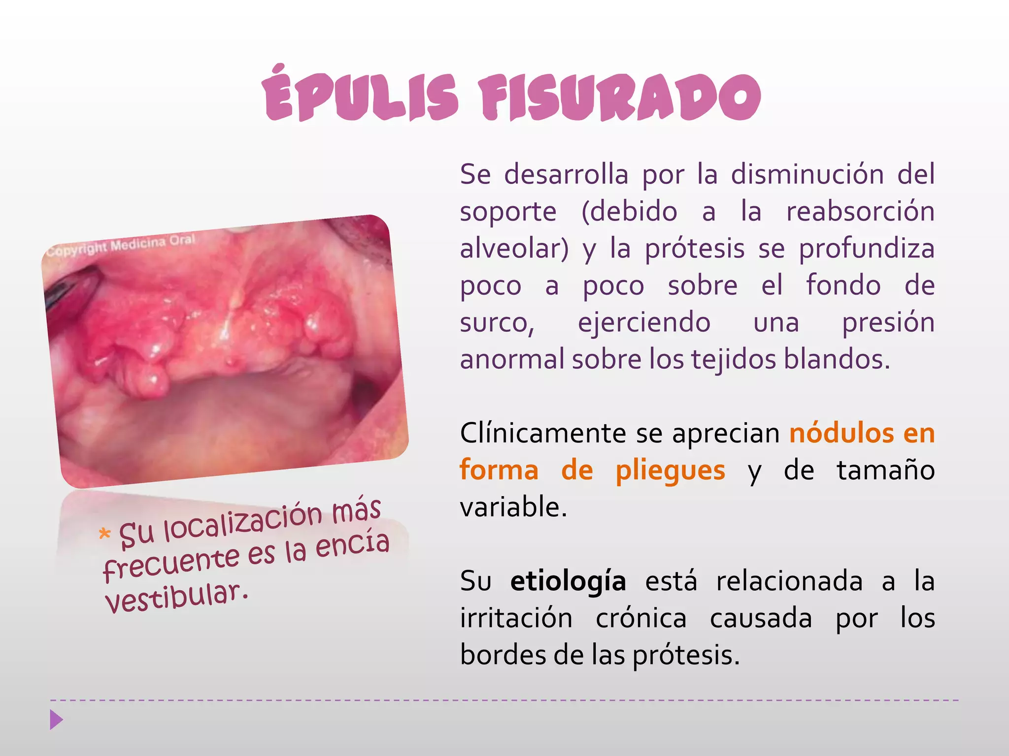 Lesiones paraprotésicas | PPTX | Dental Health | Diseases and Conditions