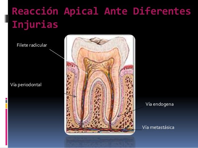 Lesiones periapicales