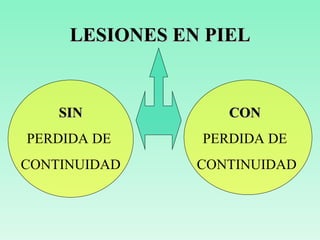 Lesiones personales | PPT
