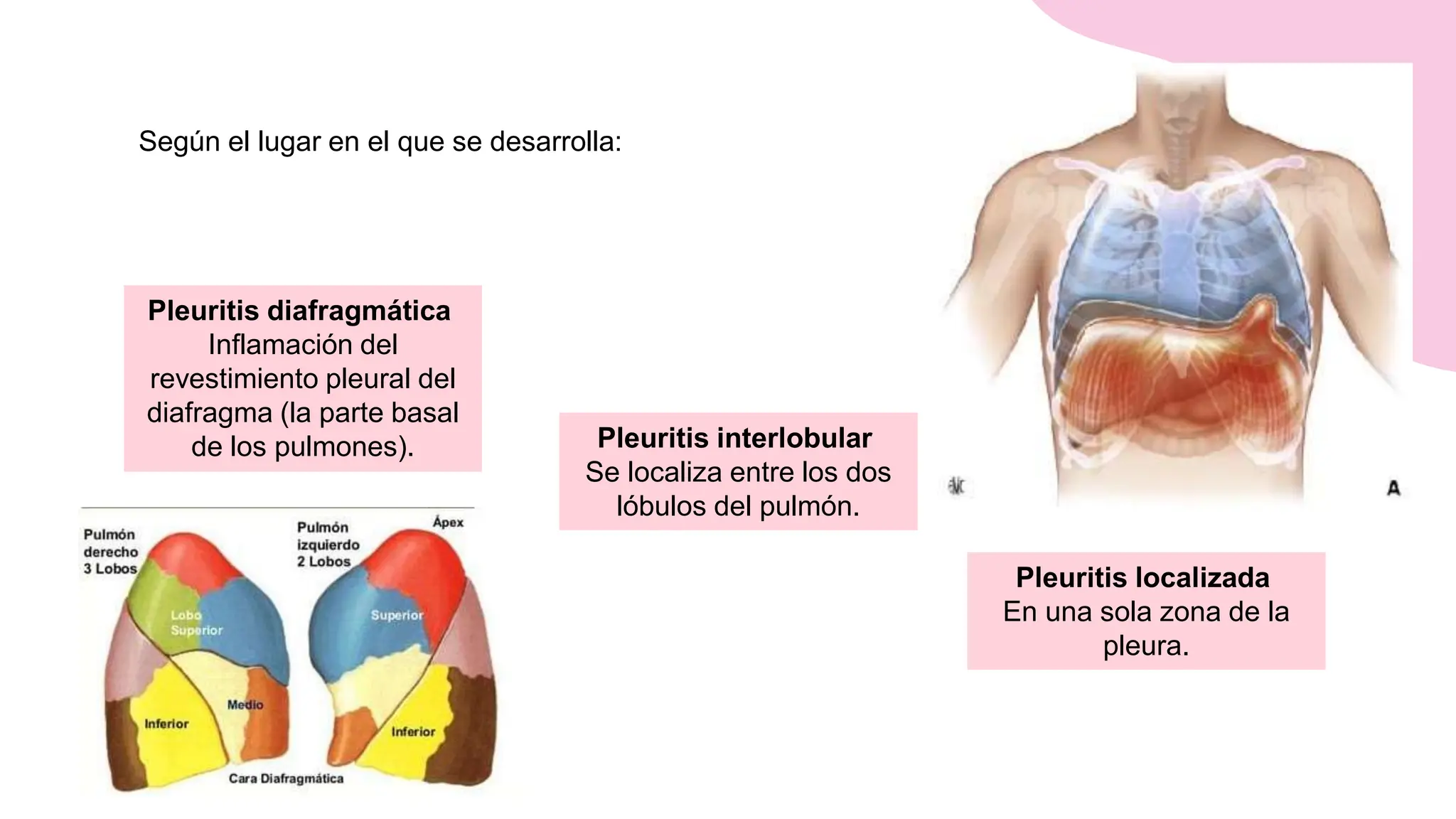 lesiones pleurales Una lesión, inflamación o infección puede hacer que ...