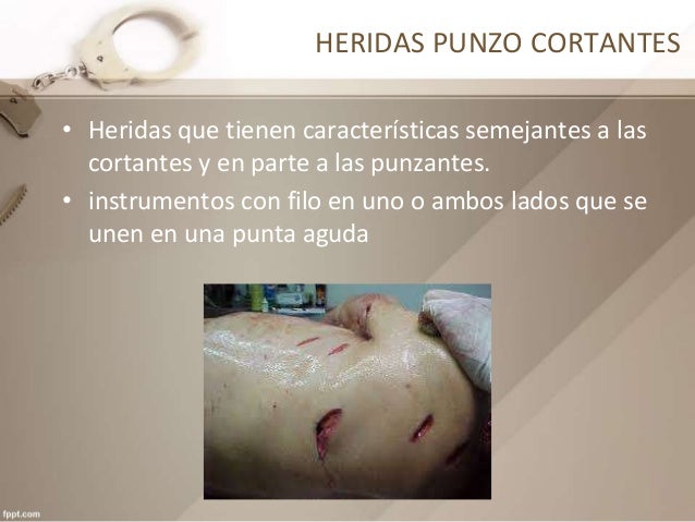 Heridas Por Arma Blanca