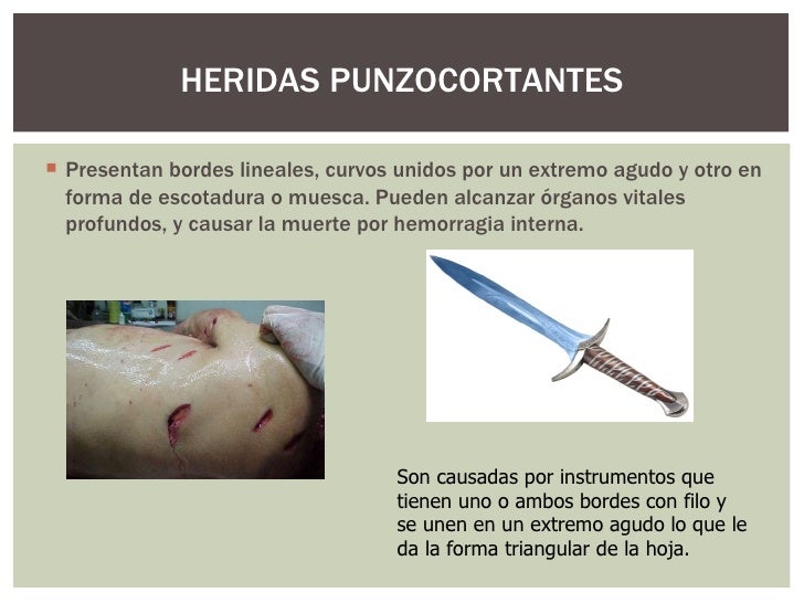 Lesiones por arma blanca