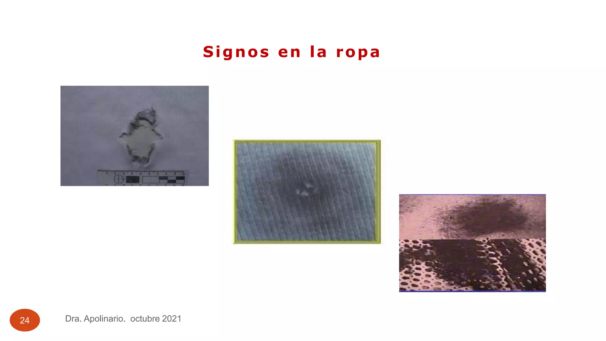 LESIONES POR ARMAS BLANCA Y ARMAS DE FUEGO UT 21-03.ppt