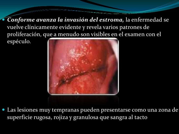 Lesiones pre invasivas y c.a cuello uterino