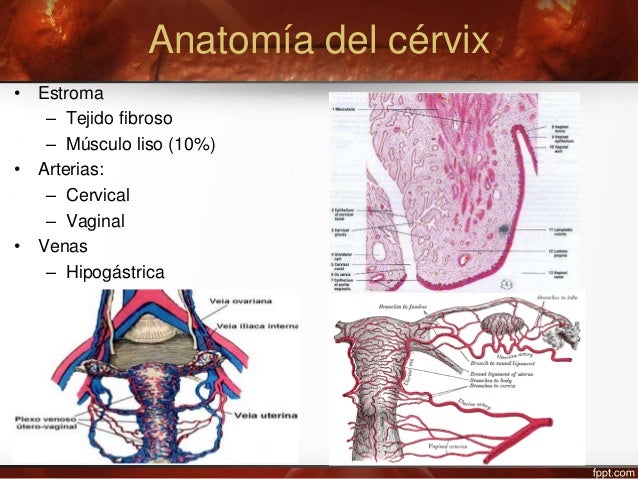 Lesiones preinvasoras del cervix