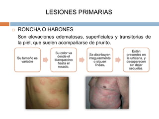 Lesiones primarias de la piel | PPTX