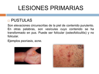 Lesiones primarias de la piel | PPTX