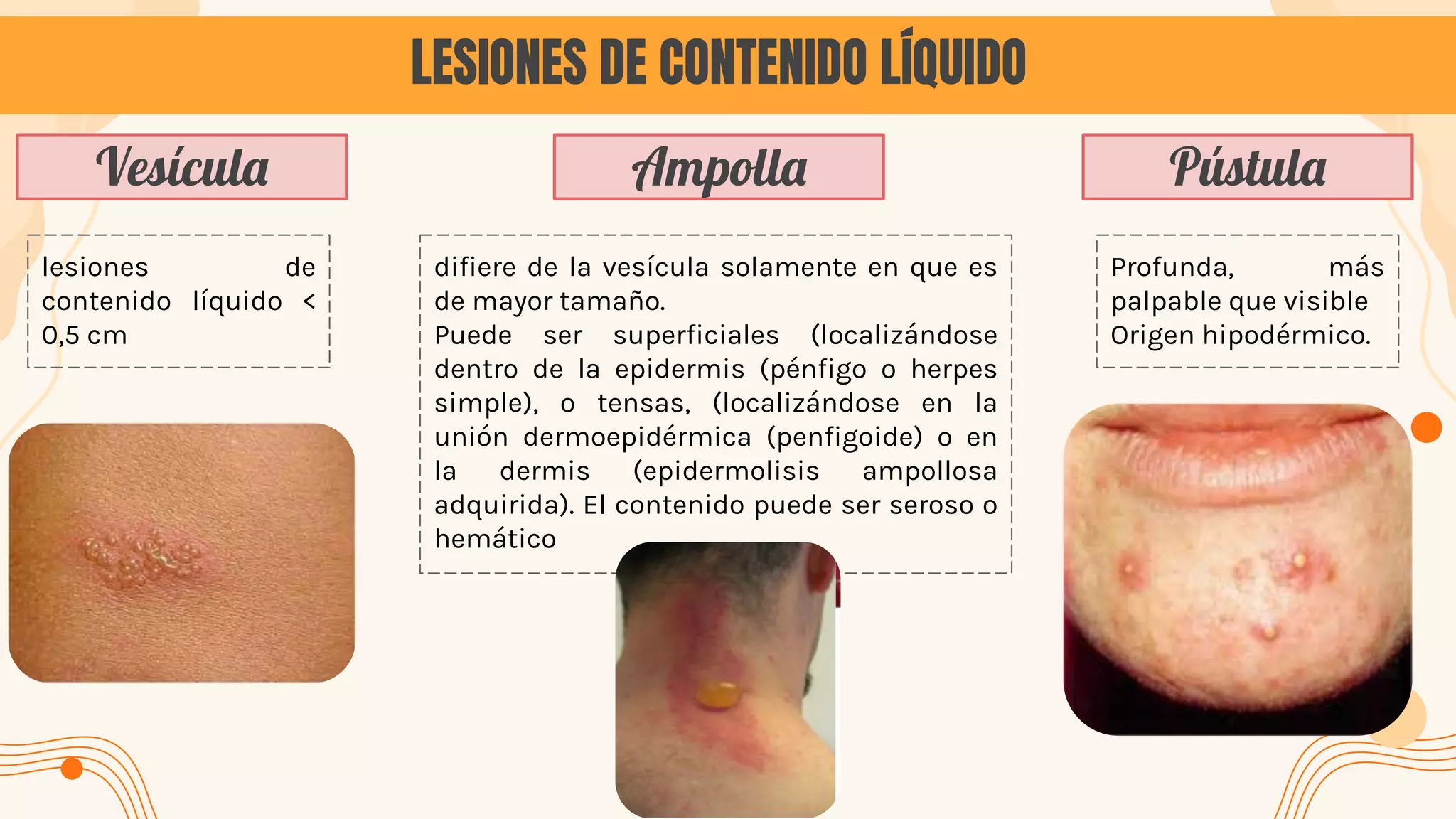 LESIONES PRIMARIAS Lesiones sólidas.pdf | Skin and Dermatology ...