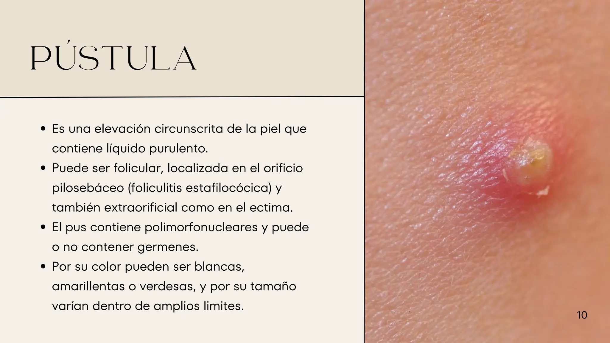 LESIONES PRIMARIAS Y SECUNDARIASsssss.pdf | Skin and Dermatology ...