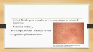 lesiones primarias y secundarias en Dermatología.pptx