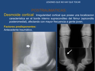 Lesiones Oseas Que No Se Deben Tocar | PPT