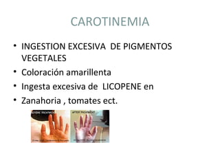 Lesiones reversibles e_irreversibles_ii_clase | PPT