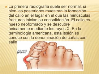Lesiones óseas del esqueleto | PPTX