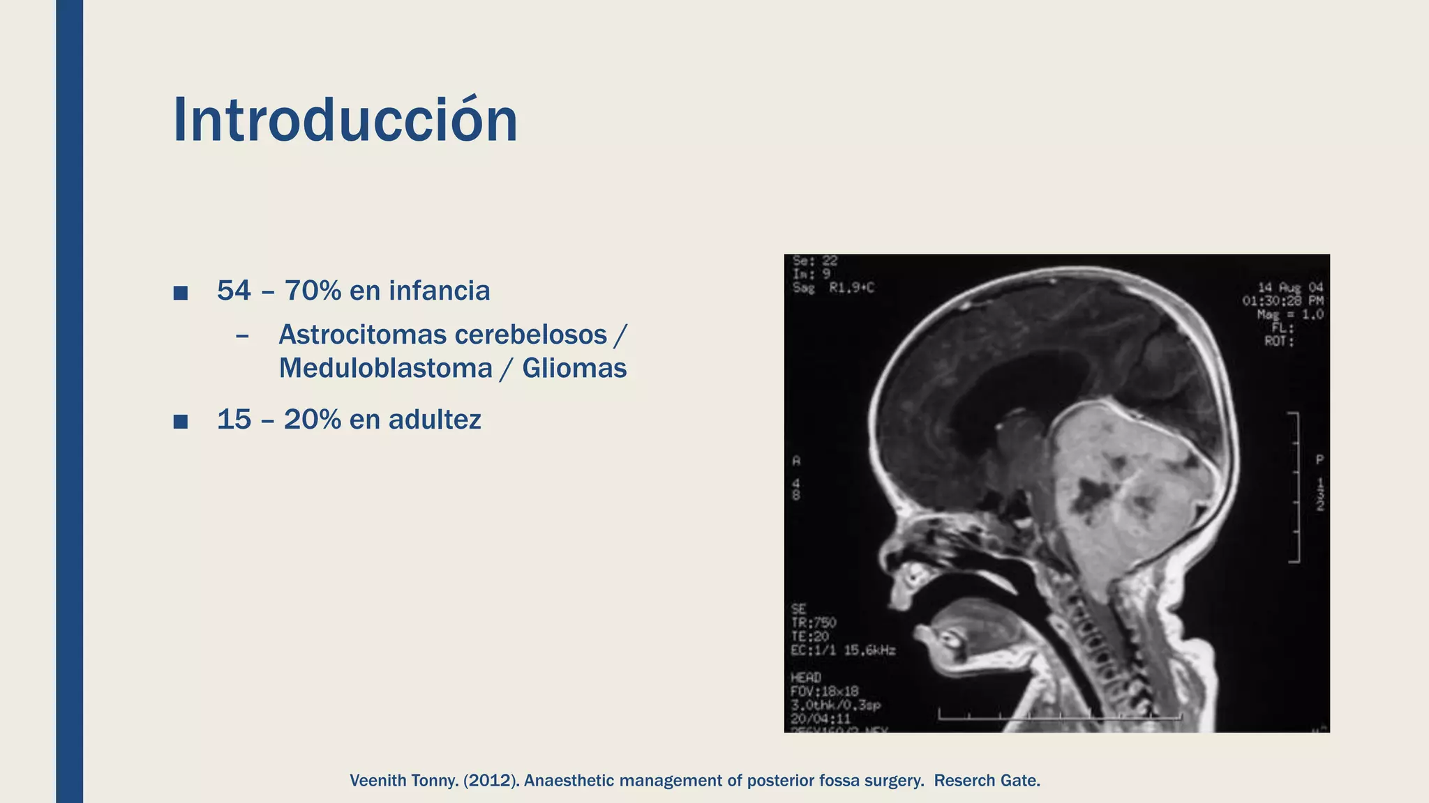 Lesiones supra o infratentoriales | PPTX