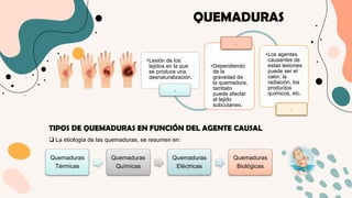lesiones termicas-hhhhhhiiyryndncndhd.pptx