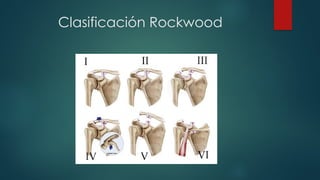 Comprehensive Overview of Traumatic Injuries to the Scapular Girdle and ...