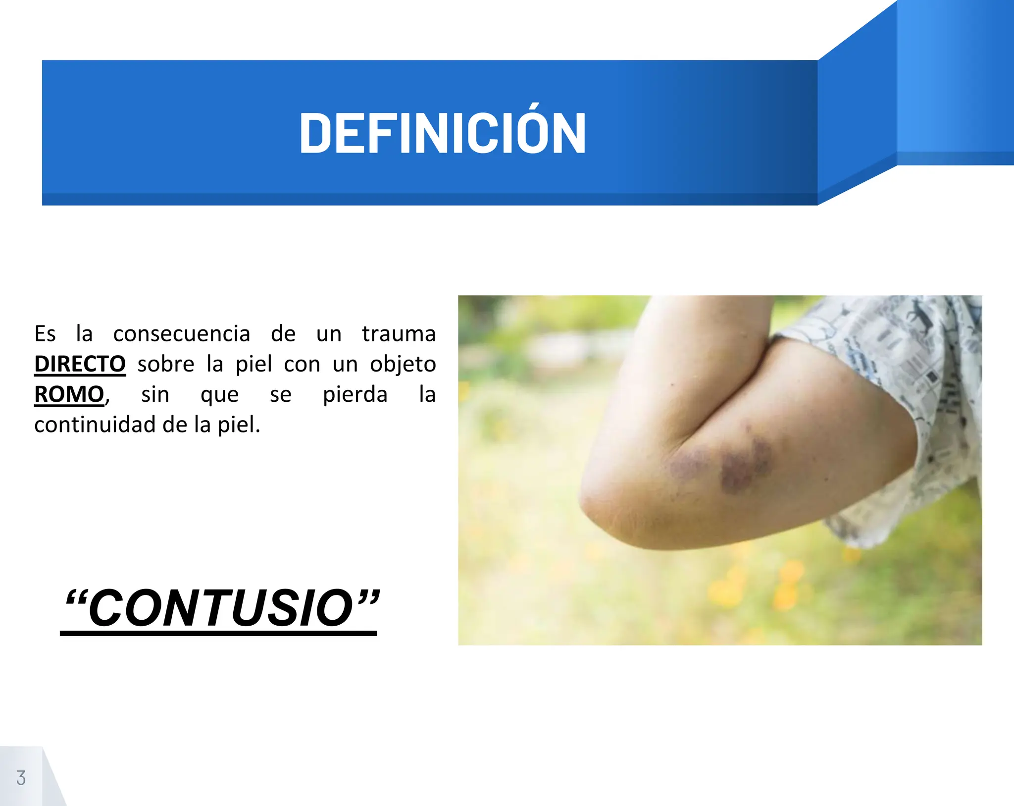 Lesiones traumáticas. Contusión, esguince y luxación | PPTX