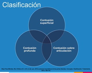 Lesiones traumáticas. Contusión, esguince y luxación | PPTX