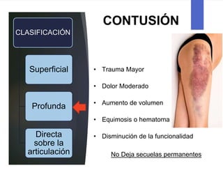 Lesiones traumáticas. Contusión, esguince y luxación | PPTX