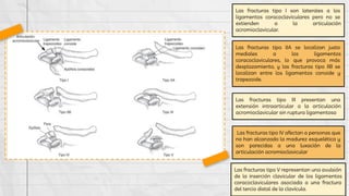 Lesiones traumáticas de cintura escapular (1).pdf