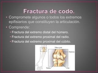 fracturas de codo | PPTX