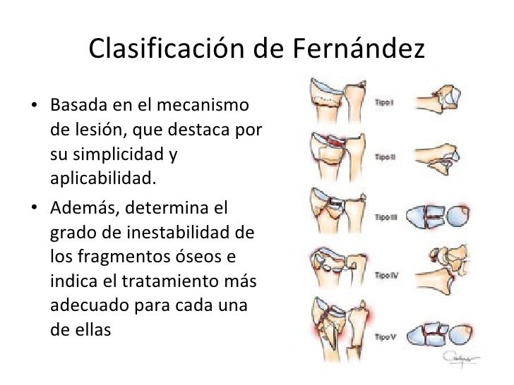 Lesiones traumáticas de la muñeca cap56