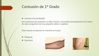 Lesiones traumáticas mas frecuentes | PPTX
