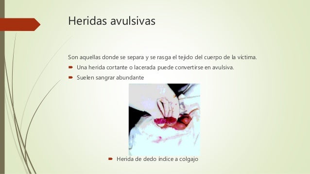 Lesiones traumáticas mas frecuentes