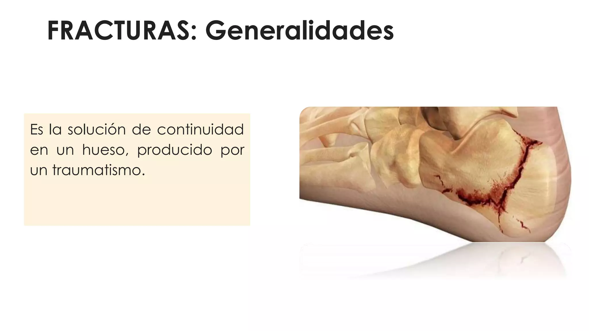 Lesiones traumáticas más frecuentes | PPTX