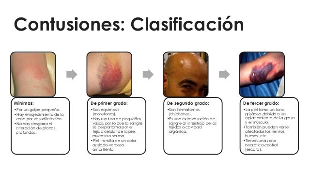 Lesiones traumáticas más frecuentes