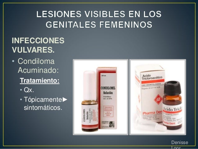 Tratamiento Condilomas Genitales – XYBAC