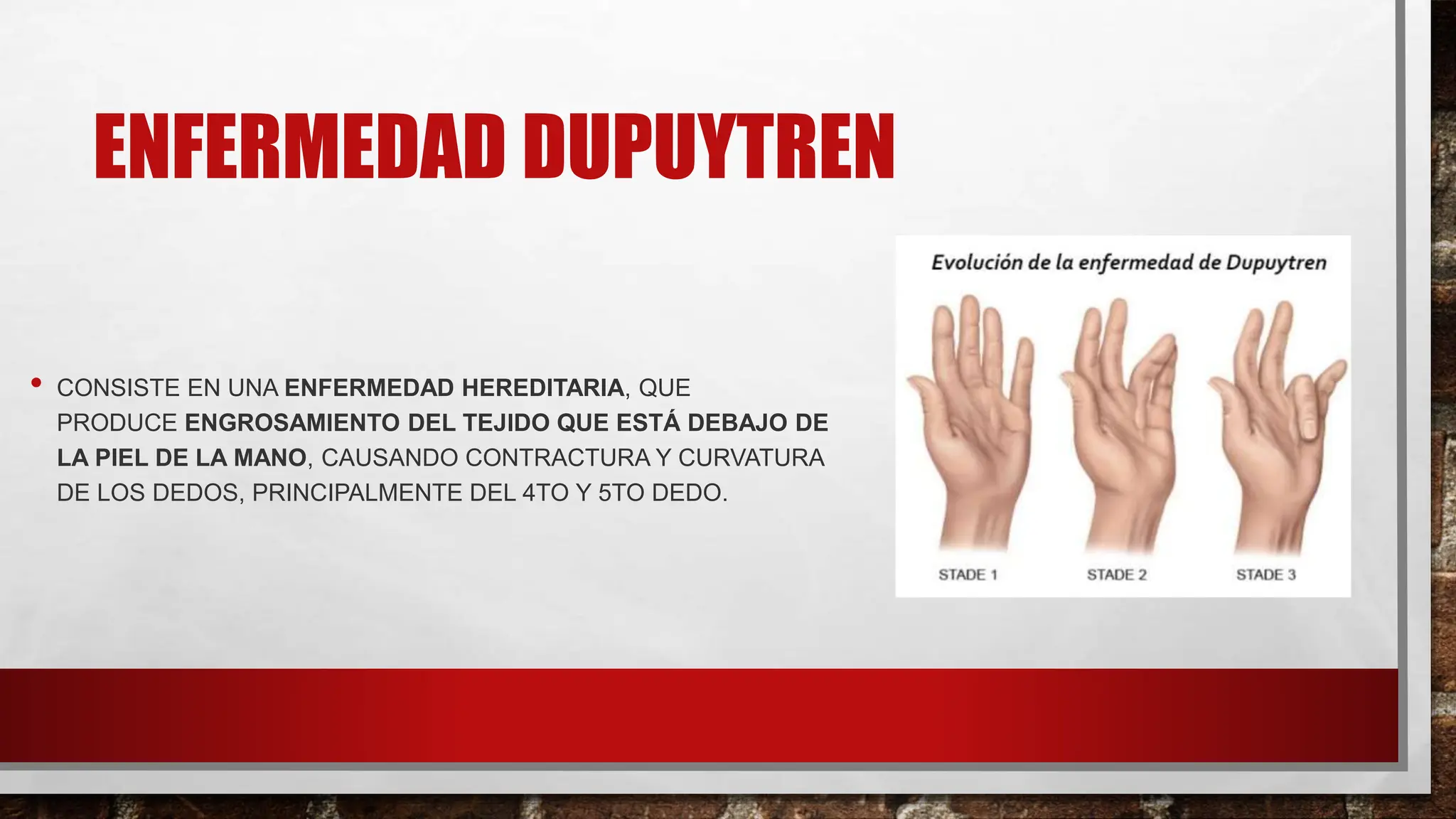 Lesiones y enfermedades de mano y de muñeca.pptx