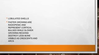 general principle of bone tumour | PPTX