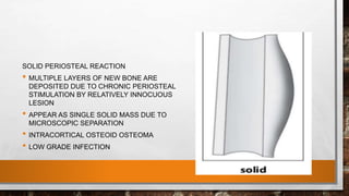 general principle of bone tumour | PPTX