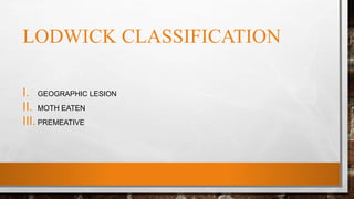 general principle of bone tumour | PPTX