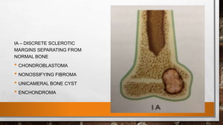 general principle of bone tumour | PPTX