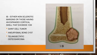 general principle of bone tumour | PPTX
